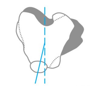 sub_patellar_info_03 – 오아시스 정형외과 신경외과 동물병원