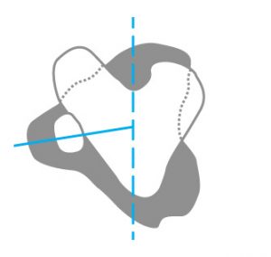 sub_patellar_info_06 – 오아시스 정형외과 신경외과 동물병원